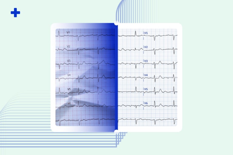ECG digitization system – our generalized solution for greater ...