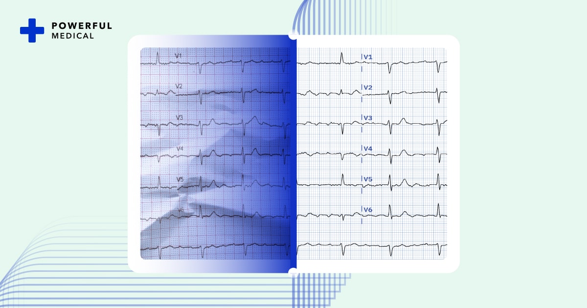 ECG digitization system – our generalized solution for greater ...