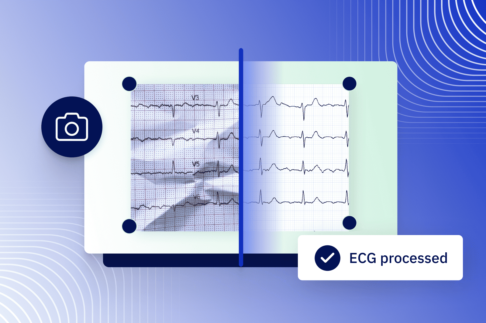 How is AI transforming ECG interpretation? | AI ECG
