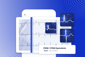 PMcardio: AI-Powered ECG Interpretation | Powerful Medical