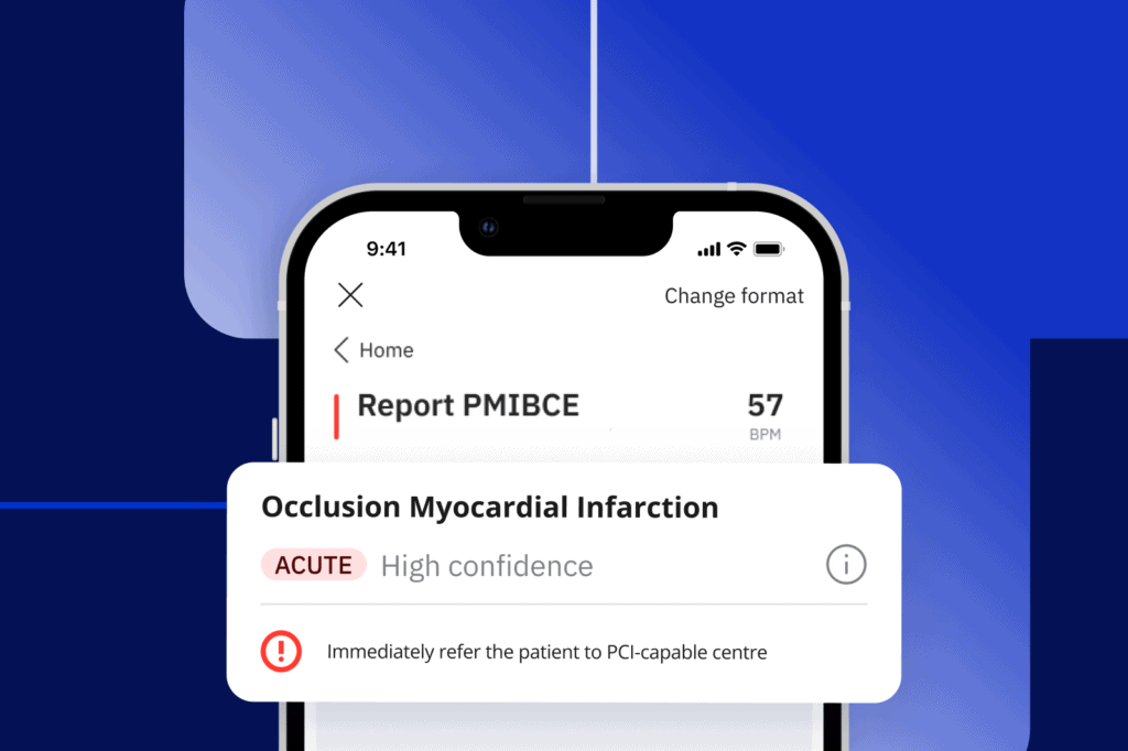 STEMI ECG Criteria: Key Insights into Ischemic ST-Elevation Patterns