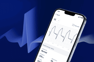 What is Occlusion Myocardial Infarction (OMI)