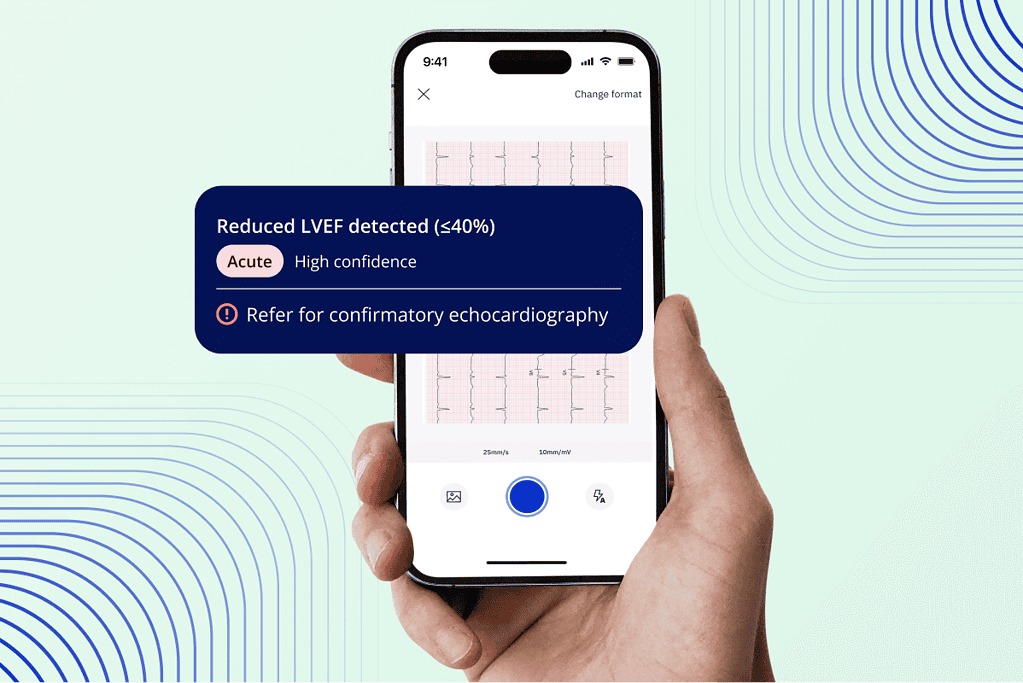 ECG Reader: AI-powered Expert Interpretation | PMcardio