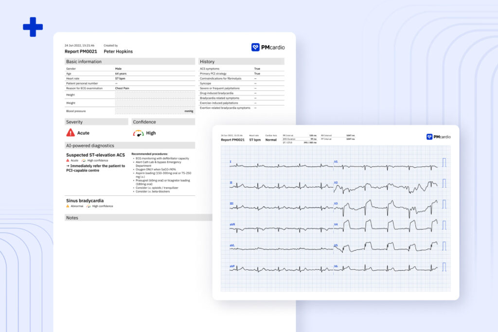 Introducing: PMcardio ECG diagnostic reports