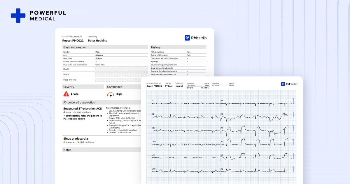 Introducing: PMcardio ECG diagnostic reports