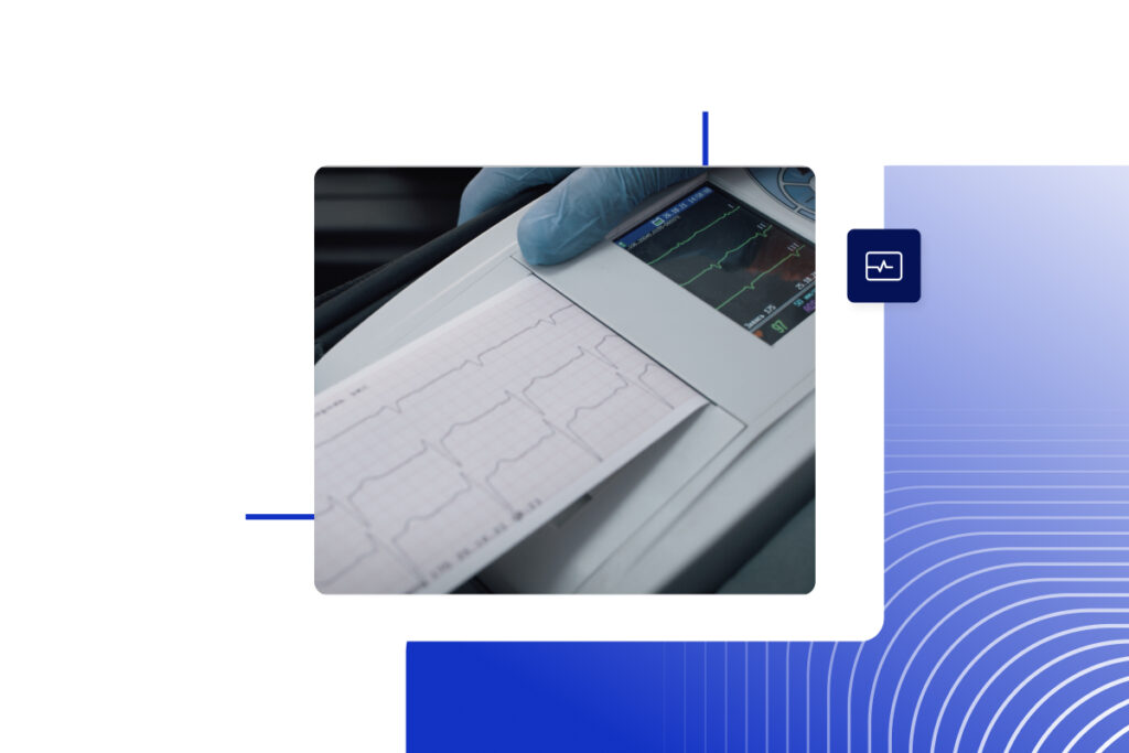 Which ECG device is the right one for your patients? Comparing 12-Lead ...