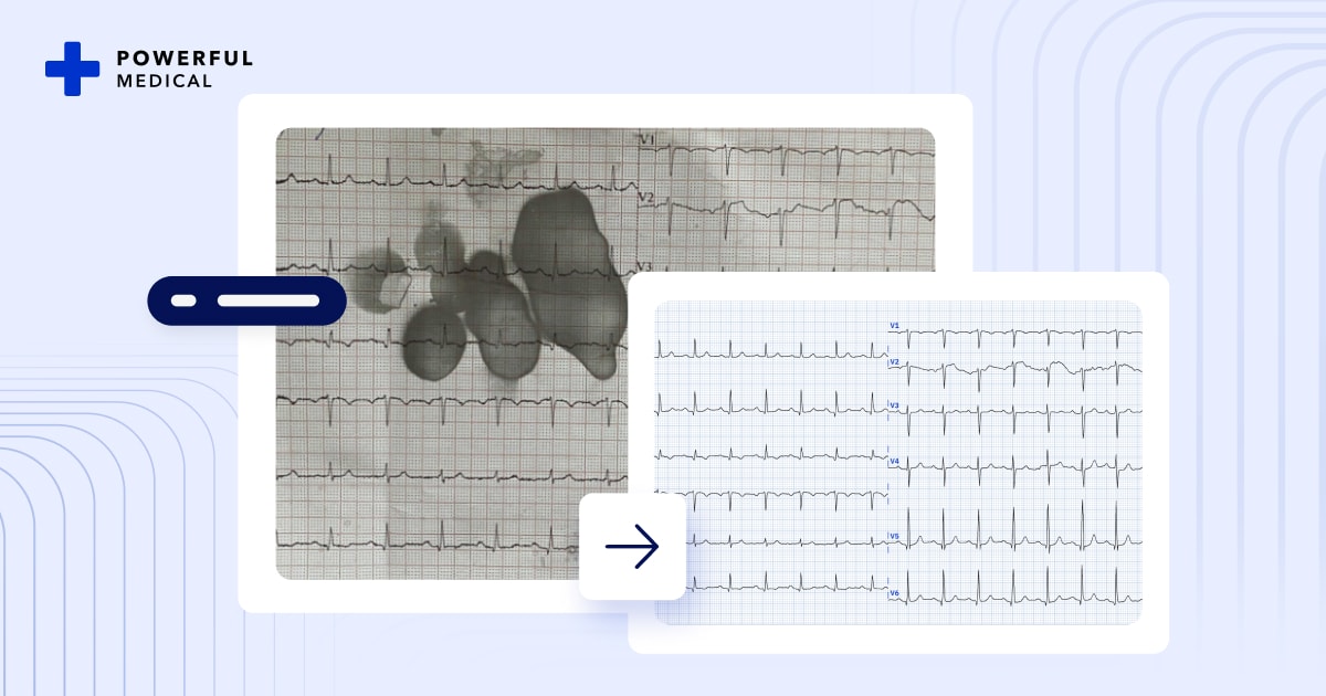 How to improve the quality of an ECG instantly (with examples)
