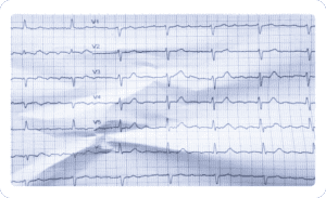 PMcardio: AI-Powered ECG Interpretation | Powerful Medical
