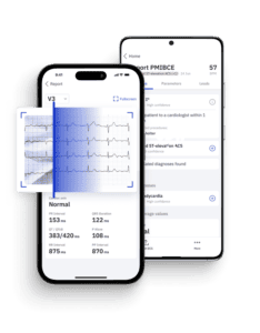 What is Occlusion Myocardial Infarction (OMI)