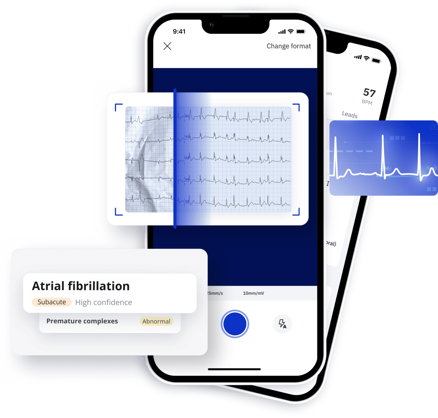PMcardio App: AI-Powered ECG Interpretation | Powerful Medical
