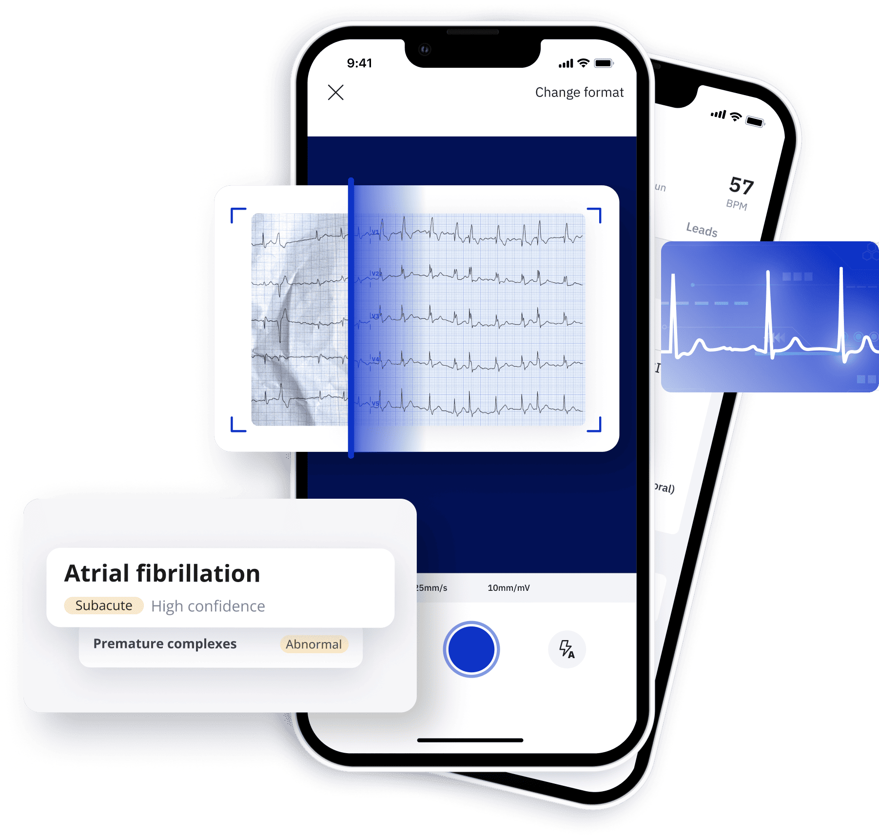PMcardio App: AI-Powered ECG Interpretation | Powerful Medical