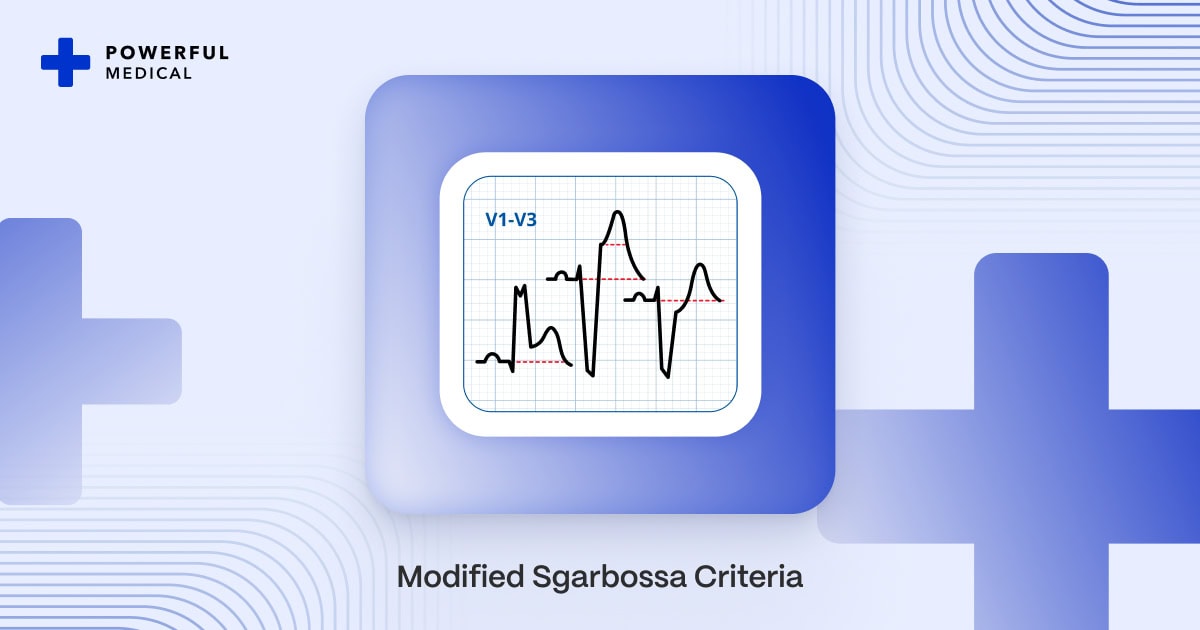 Sgarbossa Criteria: Advanced Cardiac Diagnosis | PMcardio