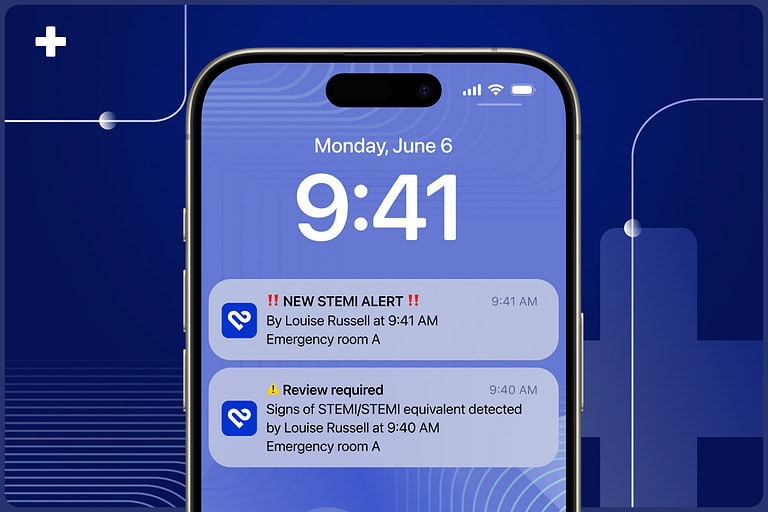 STEMI ECG Criteria: Key Insights into Ischemic ST-Elevation Patterns