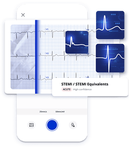 PMcardio STEMI AI ECG Model | Queen of Hearts