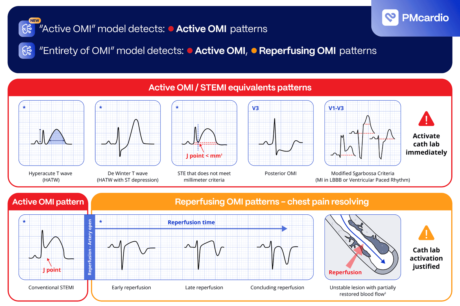 Advanced STEMI Detection and Improved Cath Lab Activation Through Notifications