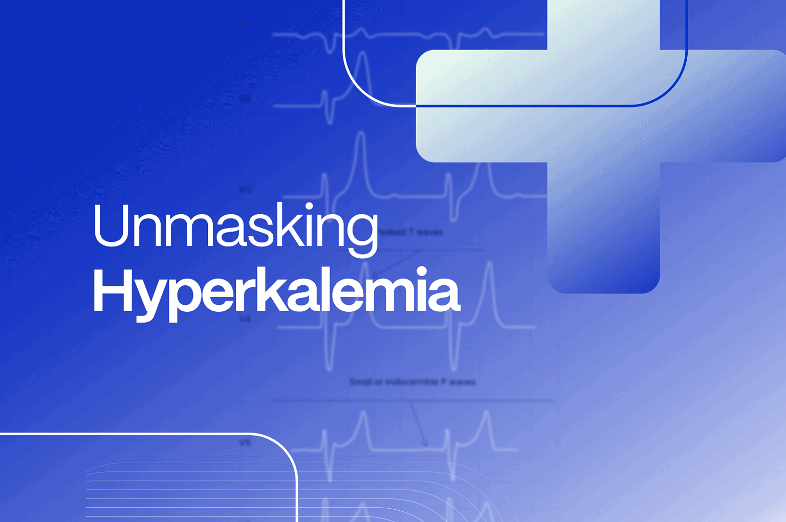 Unmasking Hyperkalemia: Highlighting Critical ECG Changes