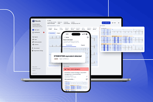 Left Ventricular Systolic Dysfunction (LVSD): The Basics and AI