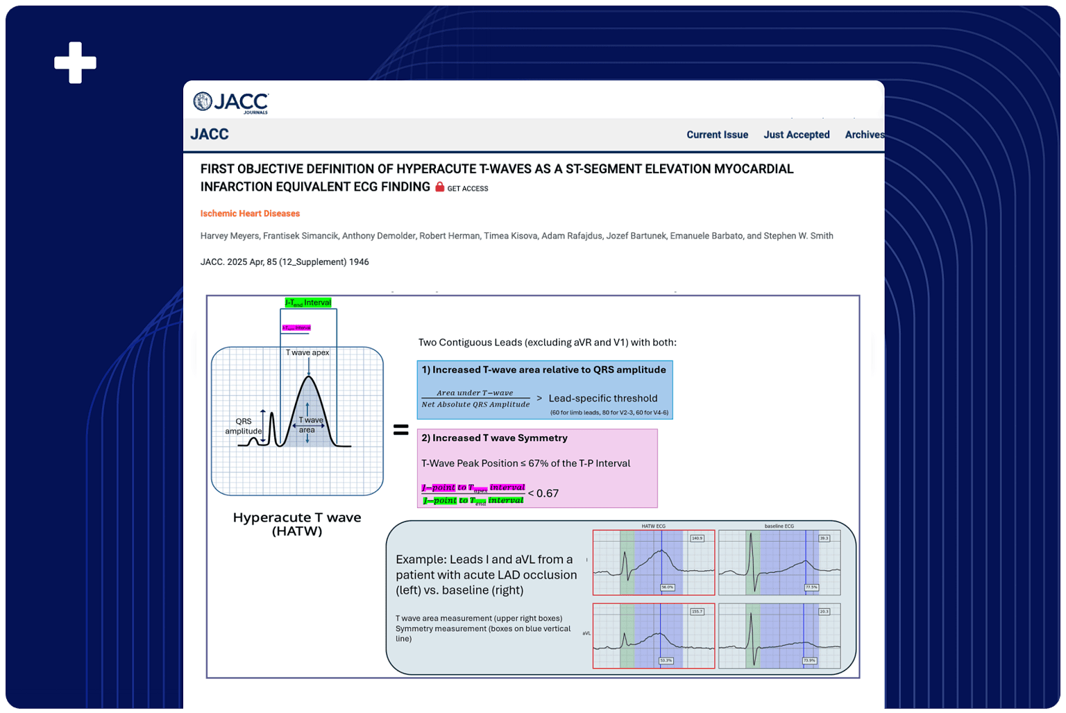 First Objective Definition of Hyperacute T-waves as a ST-segment Elevation Myocardial Infarction ...