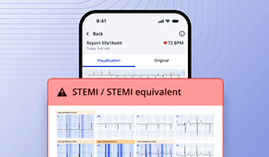 PMcardio STEMI AI ECG Model | Queen of Hearts