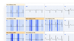 PMcardio: AI-Powered ECG Interpretation | Powerful Medical
