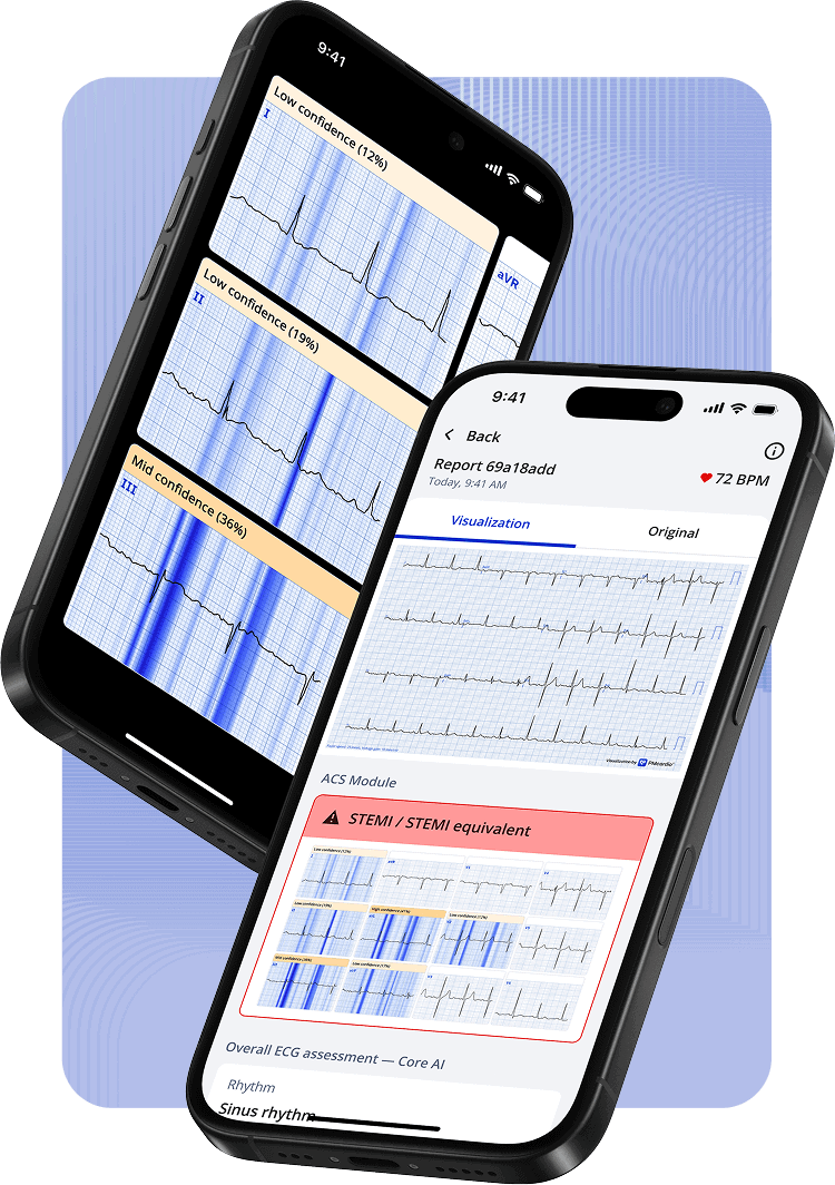 PMcardio: AI that reads ECGs in seconds | Powerful Medical