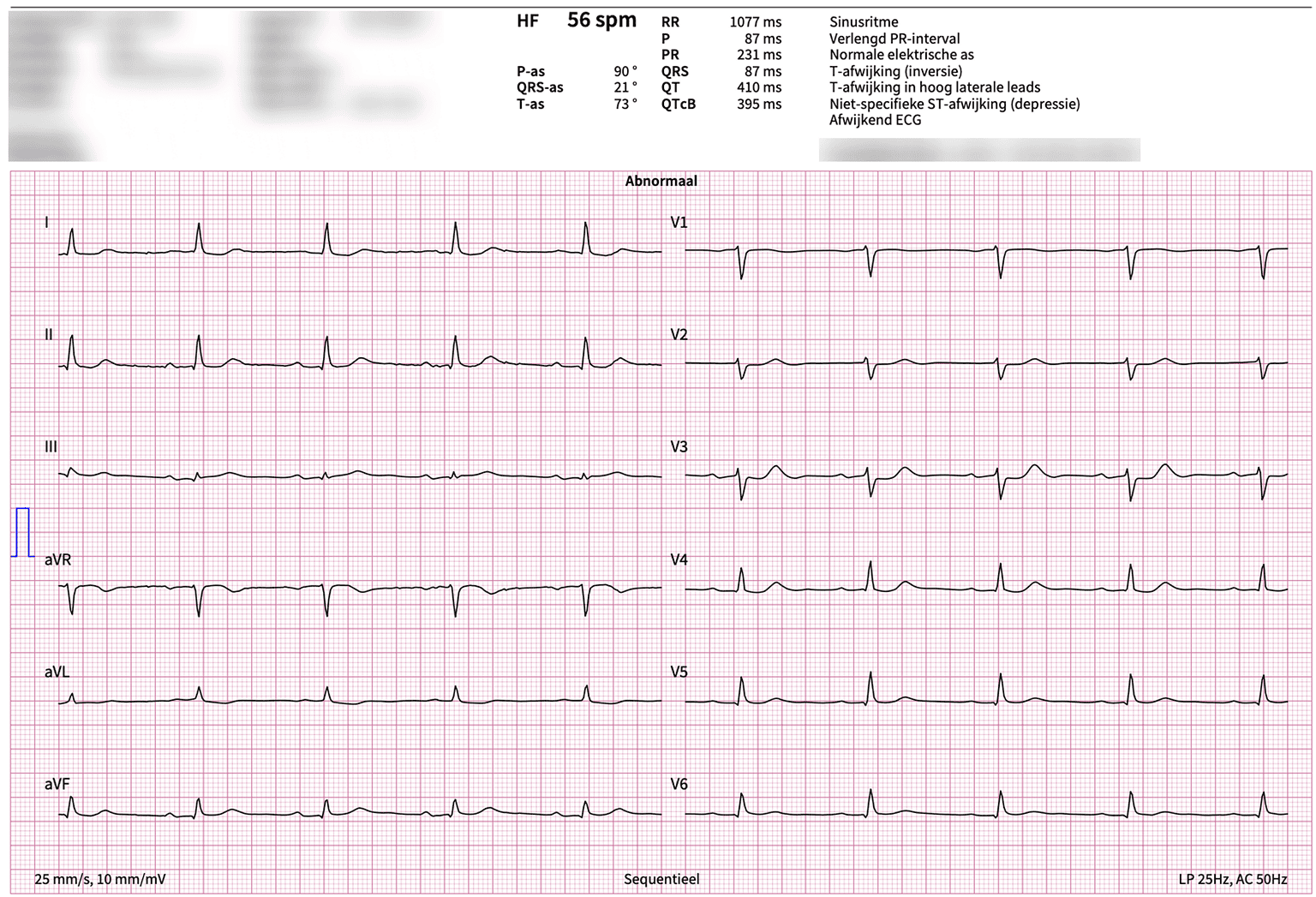 ECG Interpretation Tools Compared – Why PMcardio Stands Out