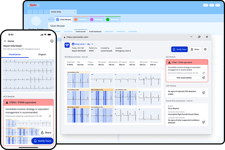 PMcardio: AI-Powered ECG Interpretation | Powerful Medical